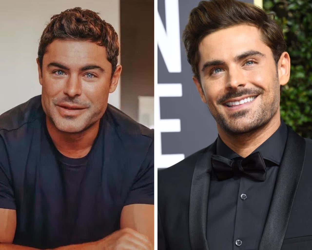 ¿Abusó del botox? Zac Efron aparece irreconocible con cambio de imagen ...